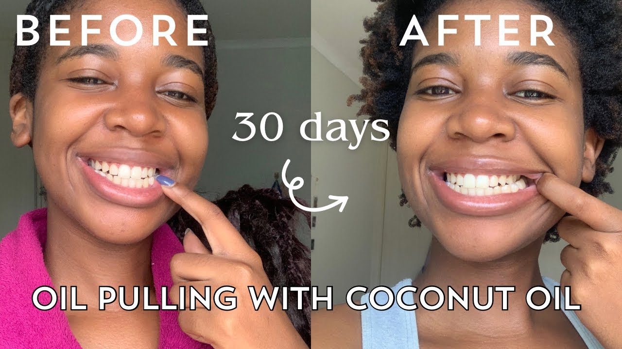 Oil Pulling Before And After Buy OldGoa Oil Pulling Cardamom