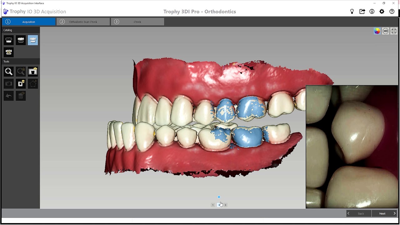 Trophy Imaging Software University | Registro de Oclusión Trophy 3DI ...