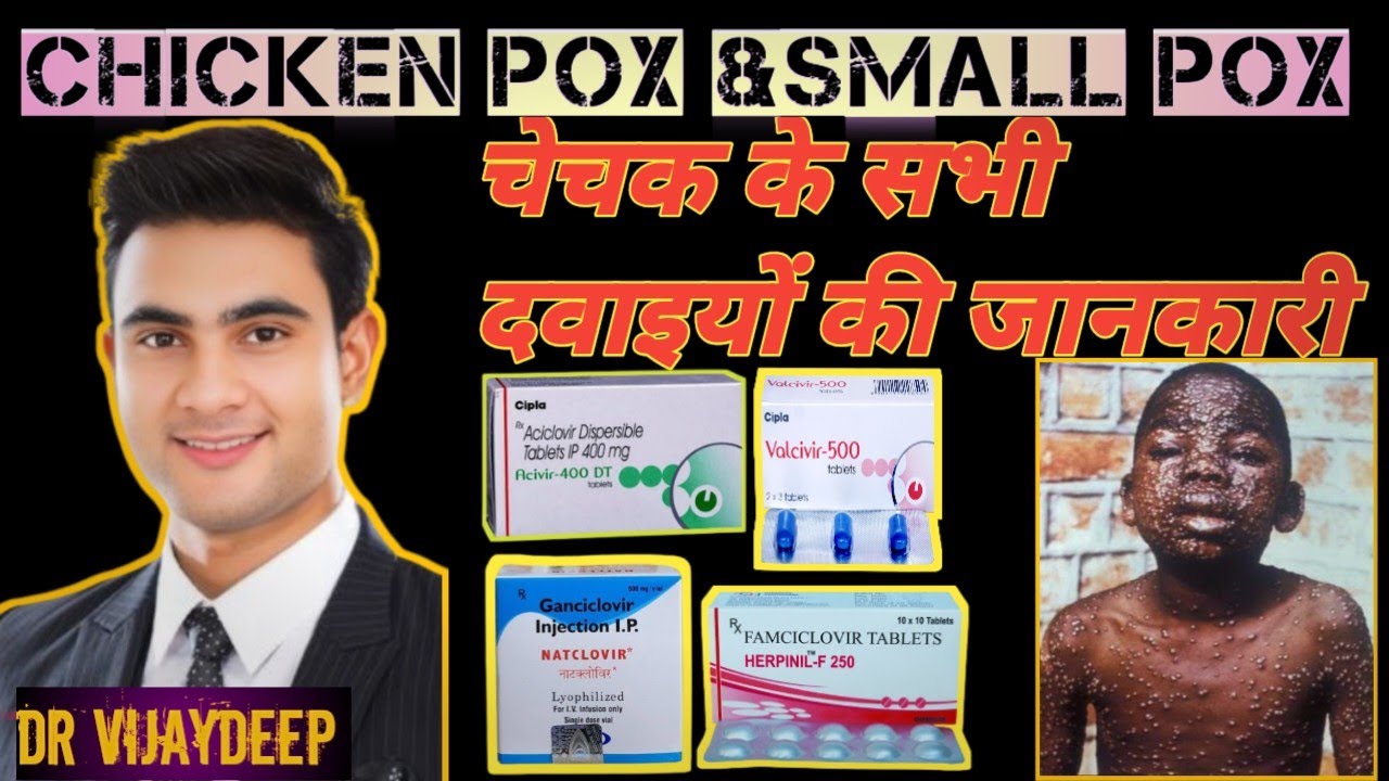 Chiken Pox | Small Pox | Antiviral Medicine | Pharmacy | B pharmacy | D ...