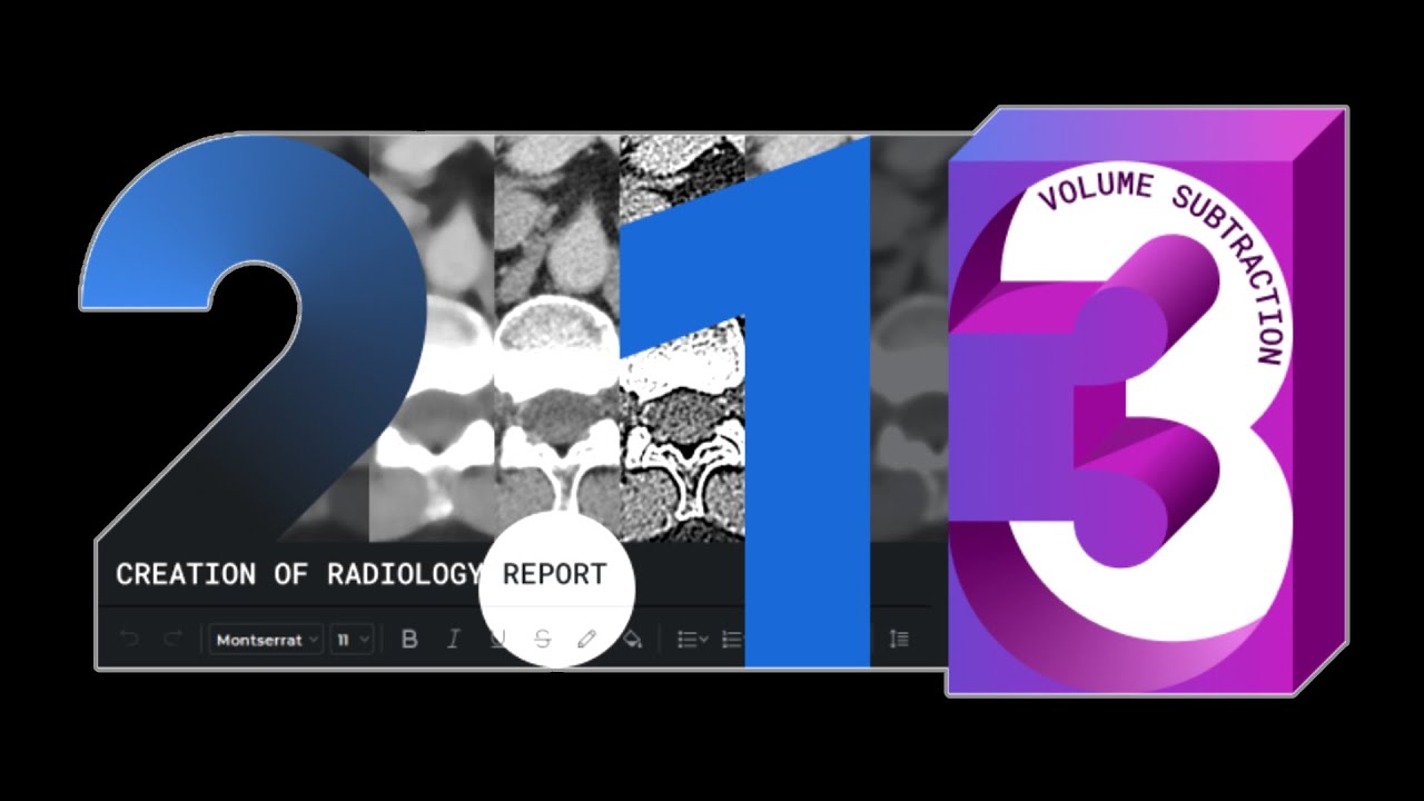 New features of Inobitec DICOM Viewer 2.13 - YouTube