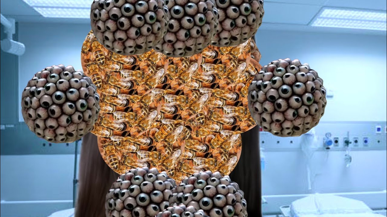 ASMR Removes insect and trypophobia face in worm treatment 2d animation ...