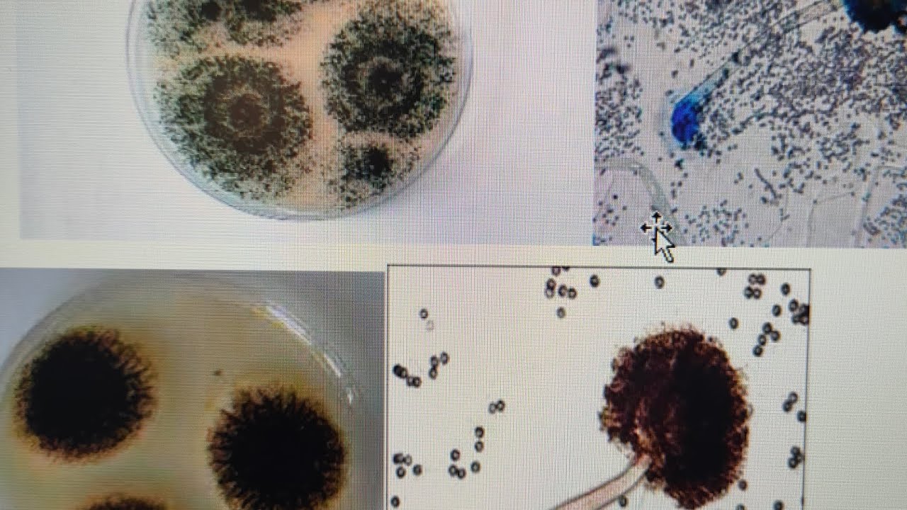 #aspergillus # fungus # detailed discussion # microbiology #immunology ...