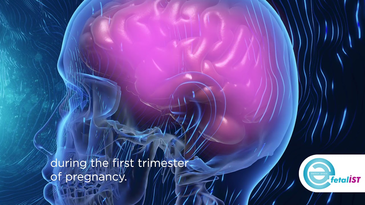 Fetal valproate syndrome (FVS) - YouTube