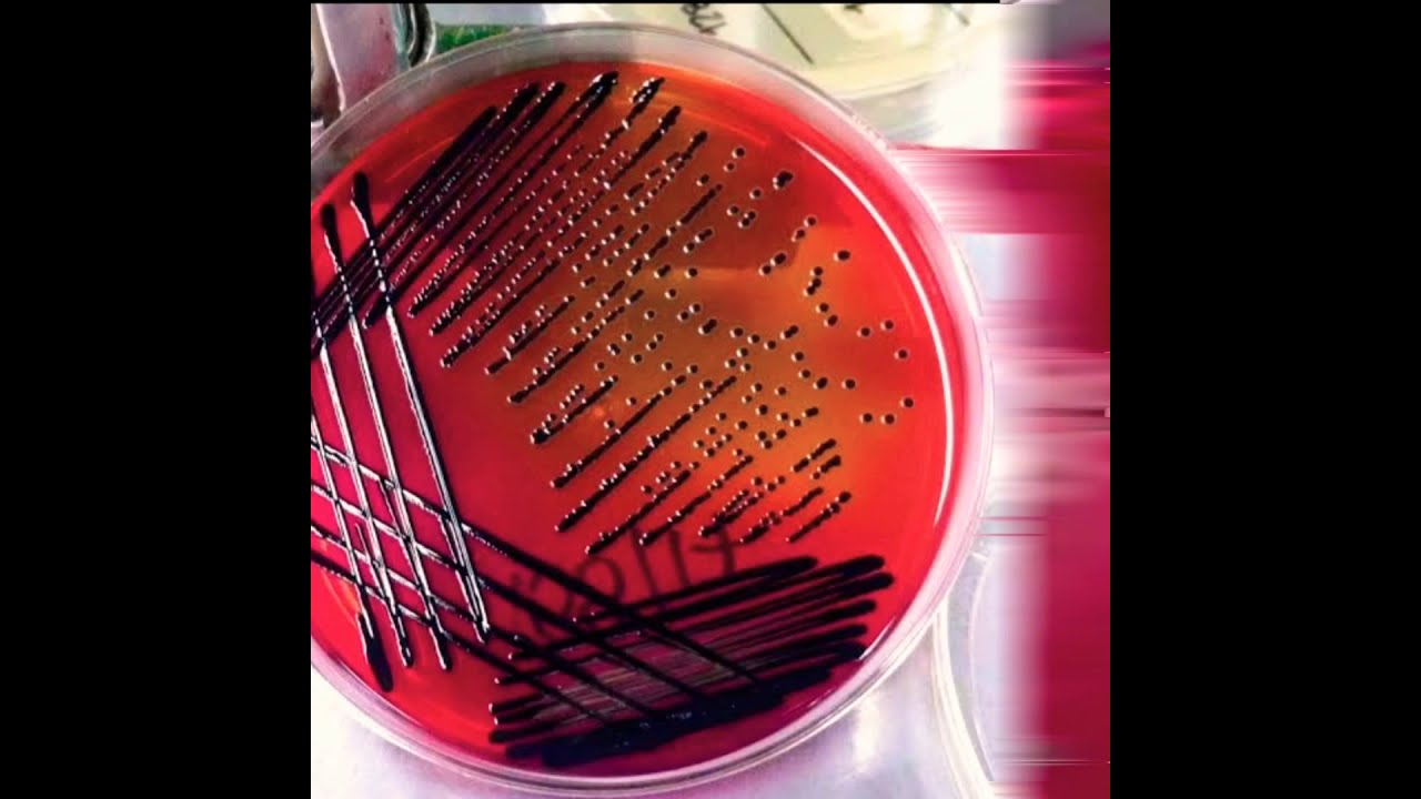 How's Salmonella typhimurium so beautiful on XLD agar ☺️⚠️ - YouTube