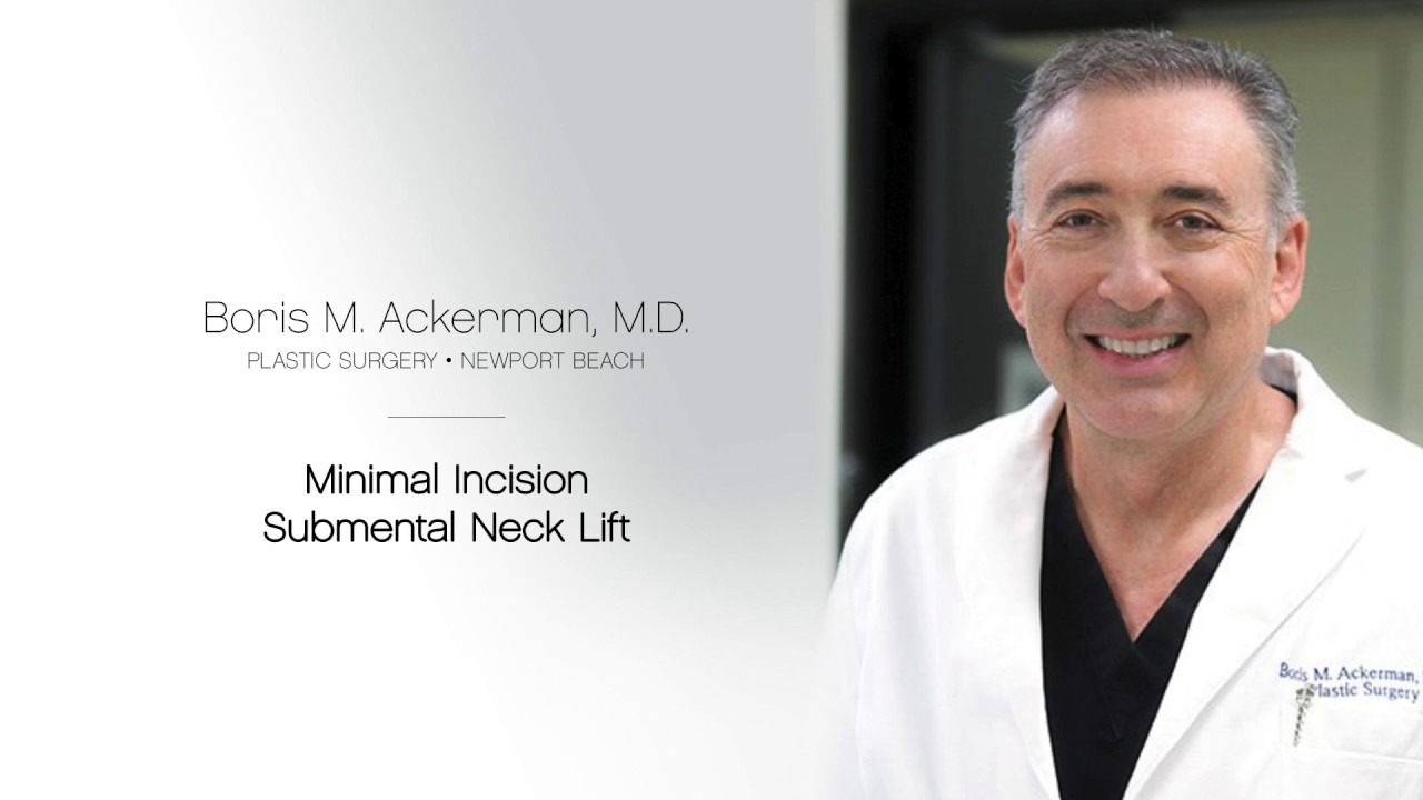 Mini Incision Submental Neck Lift Procedure - YouTube