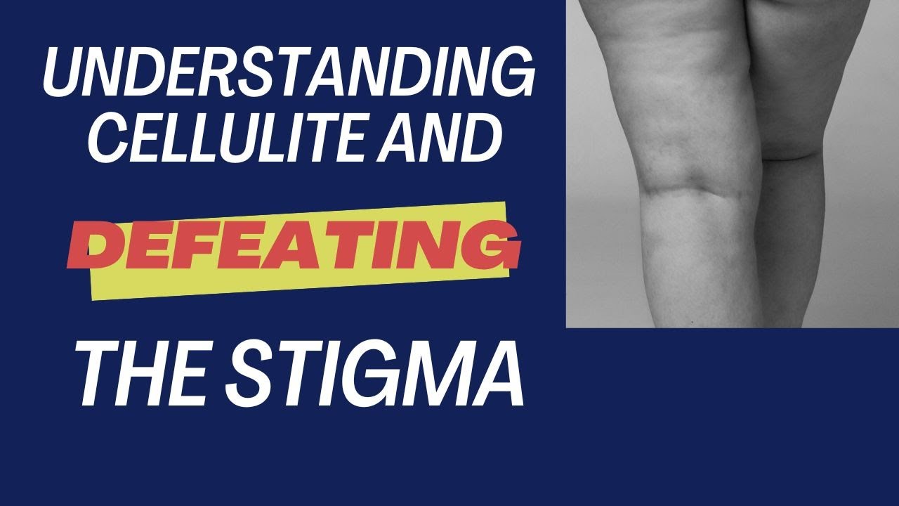 Understanding Cellulite and Defeating the Stigma - YouTube