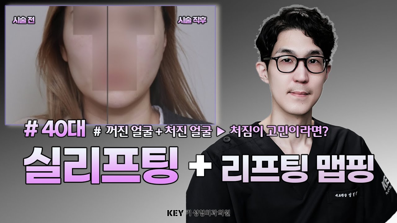 대구실리프팅 실리프팅 부작용 걱정이라면 ︎대구 실리프팅 후기 시술직후 모습 ︎ 대구실리프팅 실리프팅 실리프팅잘하는곳