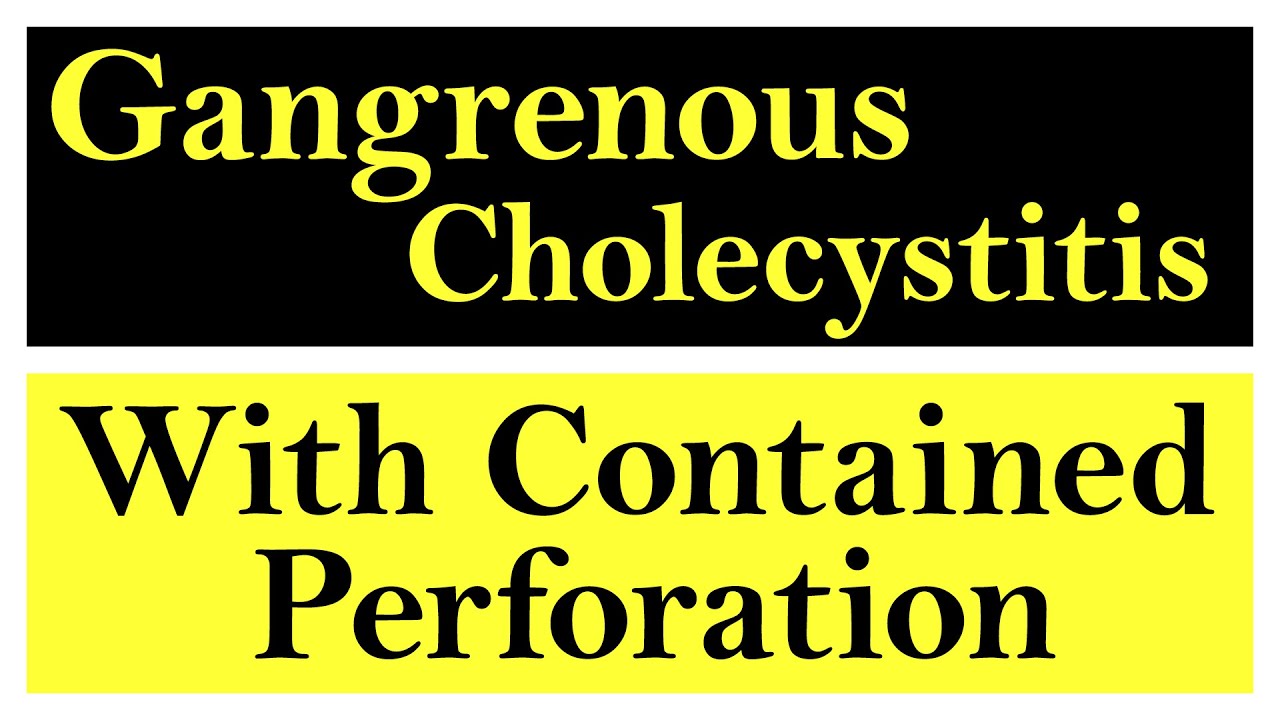Gangrenous Cholecystitis With Contained Perforation-Fundus First ...