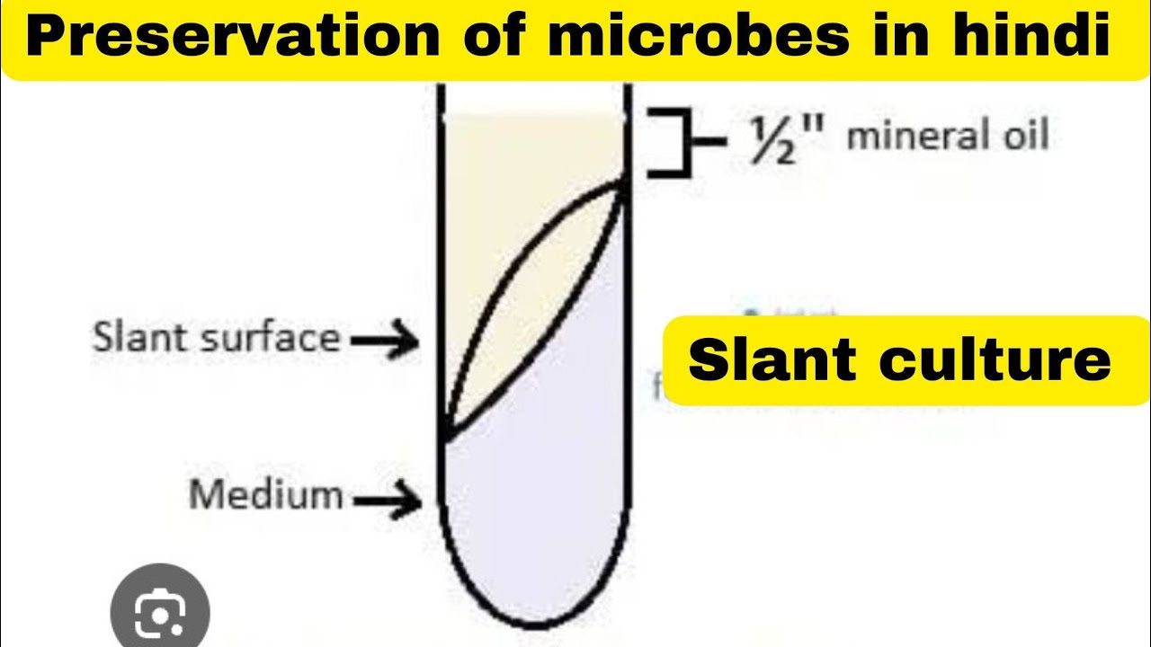 preservation of microbes|| slant culture in hindi - YouTube