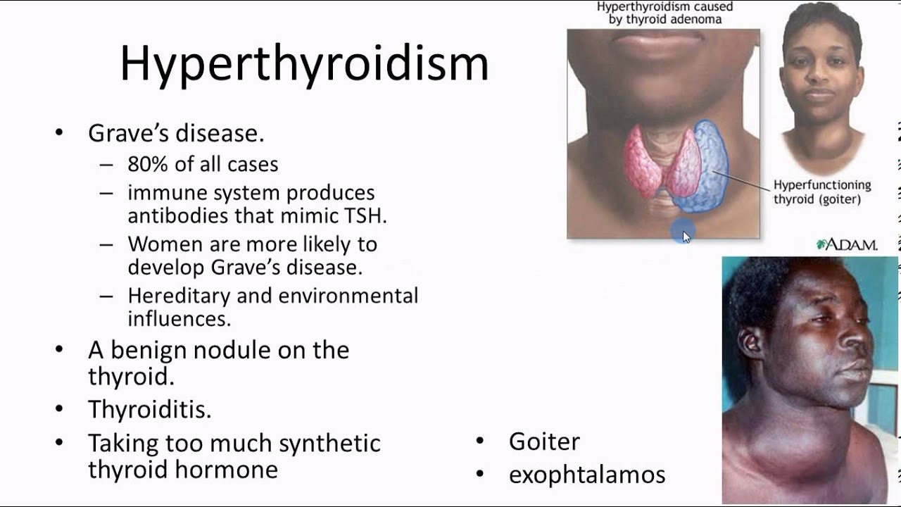 Pathophysiology Endocrine 2 of 3 - YouTube