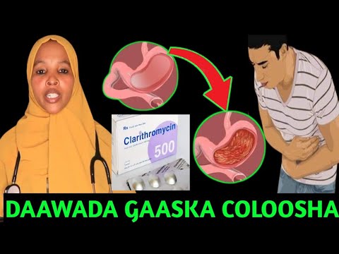 SI FUDUD ISKAGA DAAWEE GAASKA CALOOSHA HADII AAD LA DHIBAN TAHAY. - YouTube