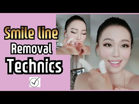 SMILE LINE REMOVAL TECHNIQUES - YouTube