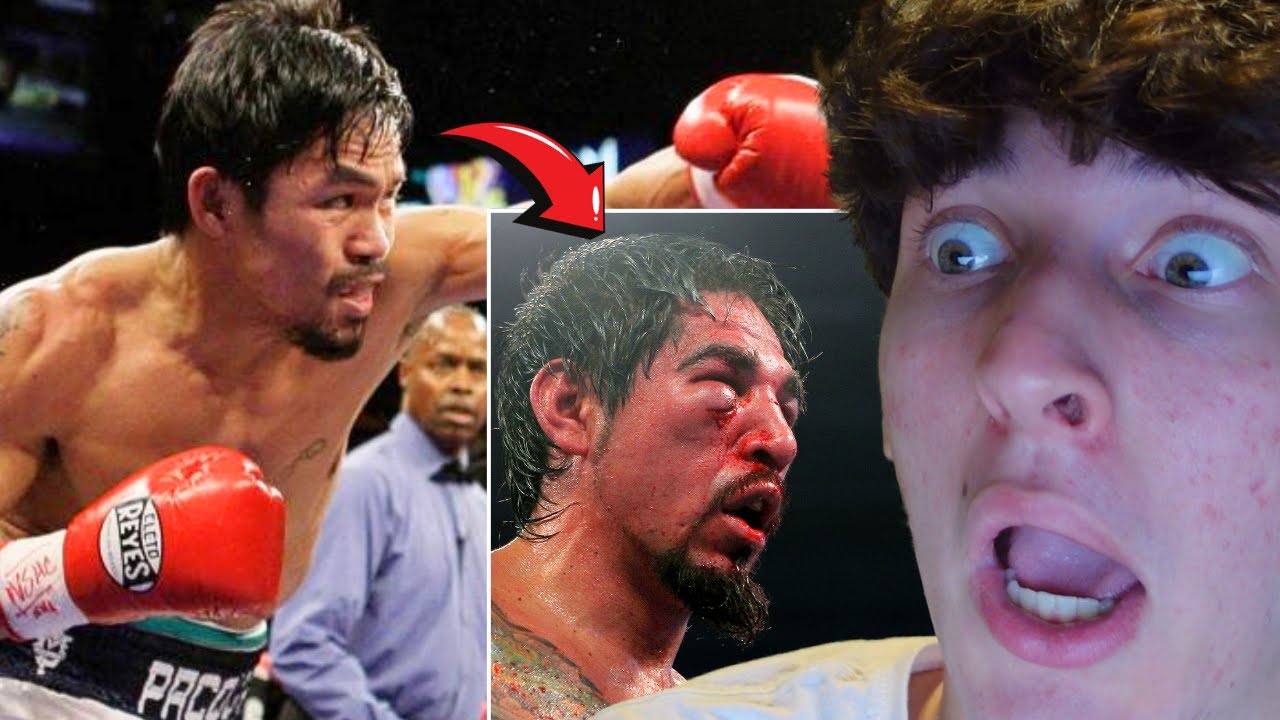 Opponents Before & After Fighting MANNY PACQUIAO... - YouTube