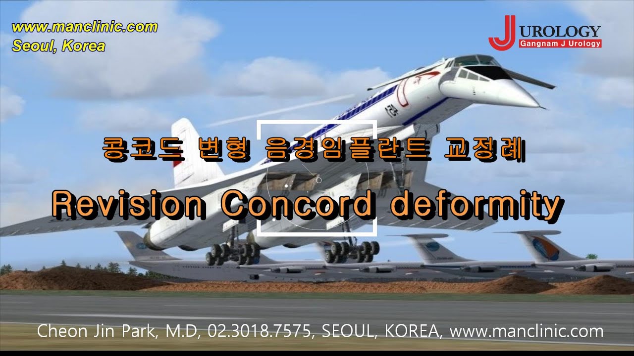Penile implant revision case of concord deformity - 콩코드 기형 음경임플란트 재수술 ...