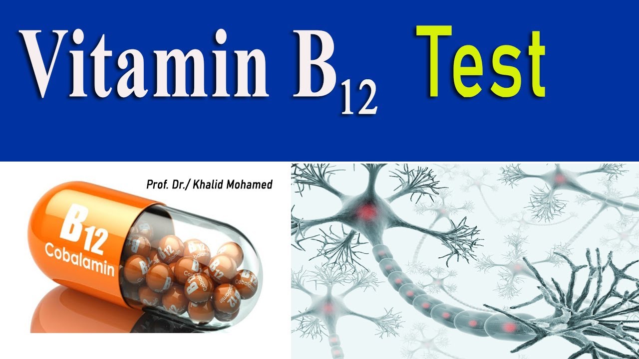 Vitamin B12 test: In-Depth Overview - YouTube
