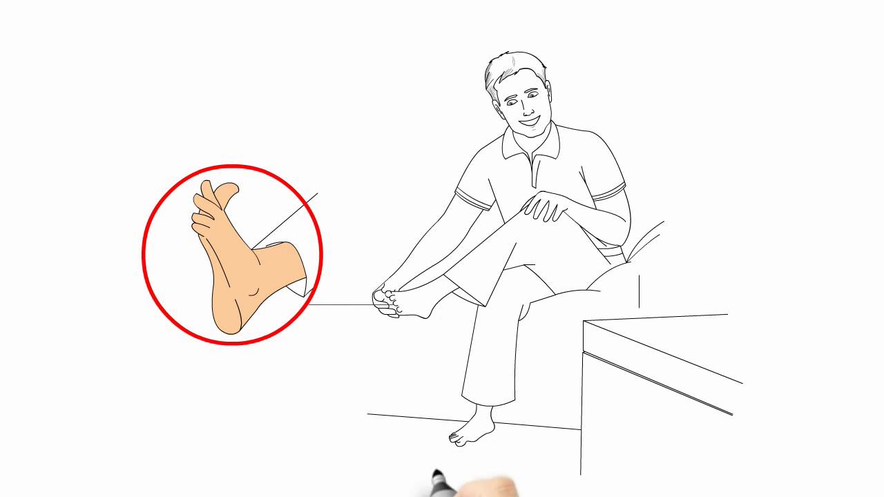 How to Examine your Feet - YouTube