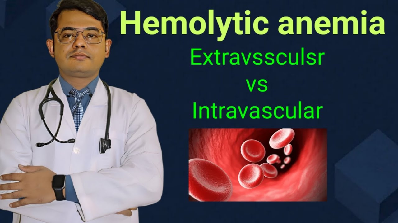 Hemolytic anemia: Extravsscular vs Intravascular : Simplified ...