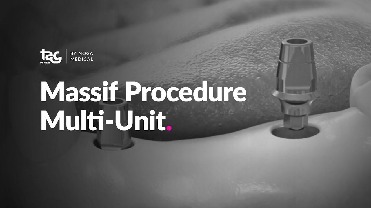 Massif Procedure Multi-Unit - YouTube