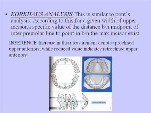 Orthodontic model analysis by Indian dental academy - YouTube