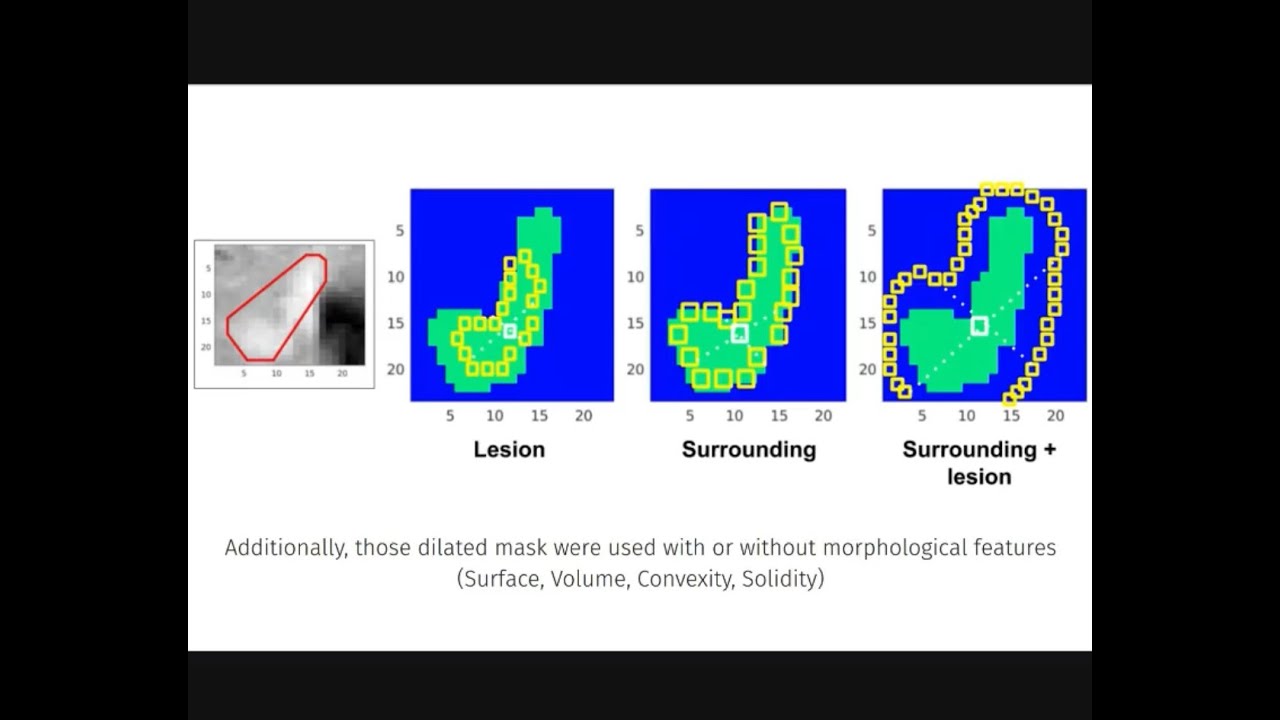 Clase ML Anomaly detection (parte 1) - YouTube