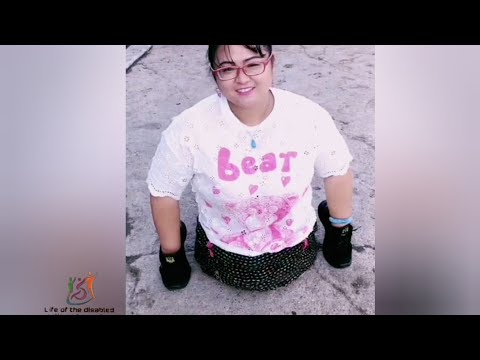 The beautiful woman with amputated legs, the disability challenge, life ...