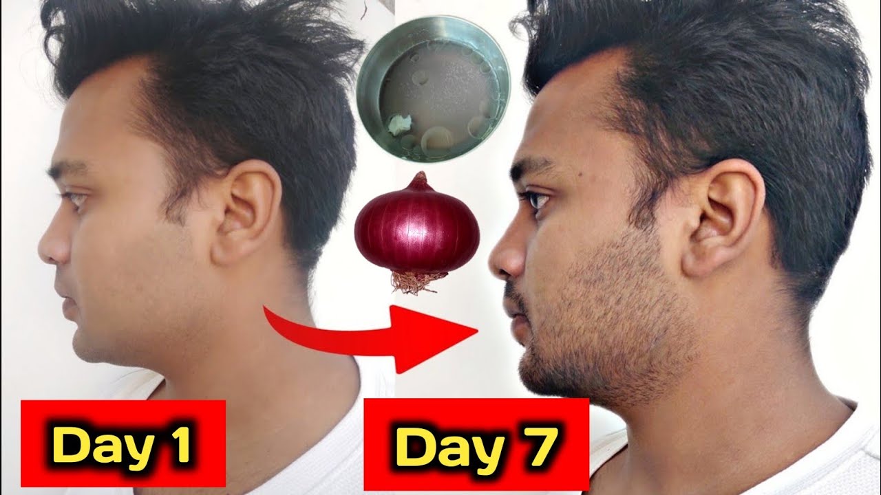 प्याज से दाढ़ी कैसे उगाए || How To Grow Beard Faster | Dadhi Kaise ...