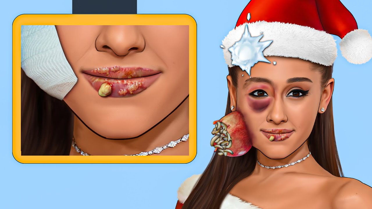ASMR Remove Big Acne Infected Face Ariana - Deep Cleaning Animation - YouTube