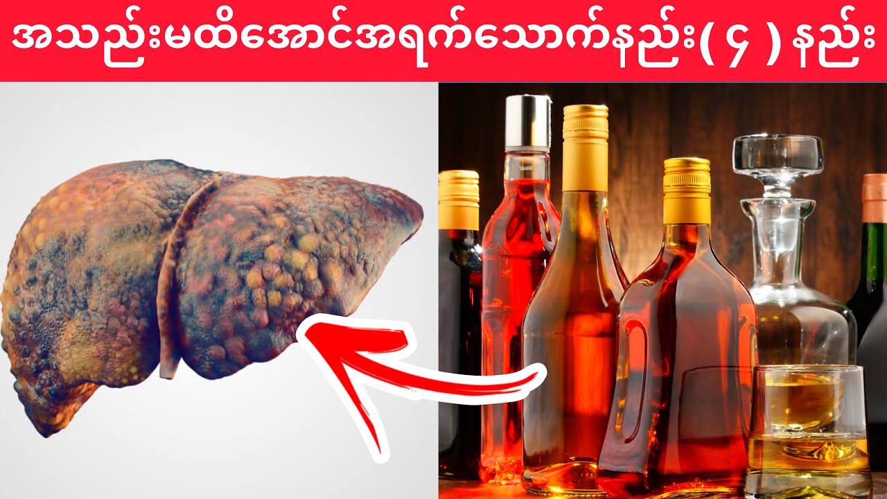 အသည်းမထိအောင် အရက်ကိုတစ်ရက်ဘယ်လောက်သောက်လို့ရလဲ [ နည်းလမ်း ၄ ခု ] Youtube