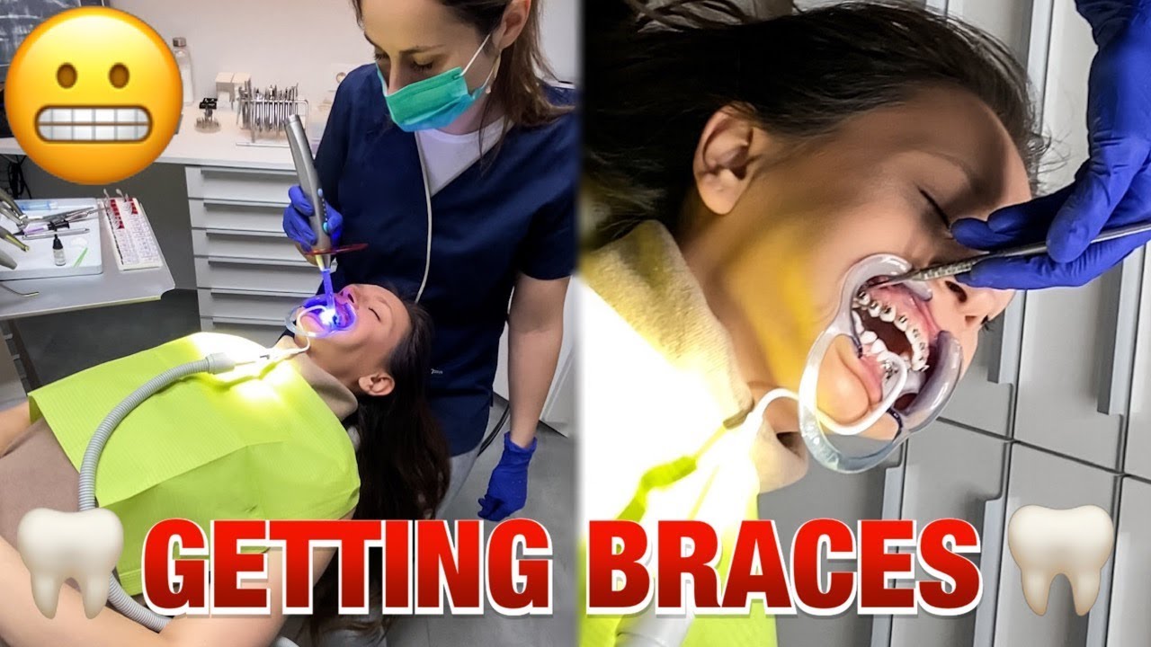 GETTING BRACES VLOG ** SHE CRIED ** - YouTube