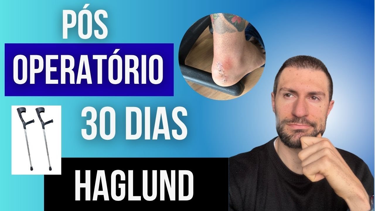 30 dias pós operatório Síndrome de Haglund - Deformidade - Esporão de ...