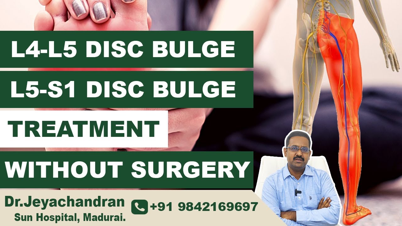 L4 L5 And L5 S1 Disc Bulge Sciatica Treatment Without Surgery Dr