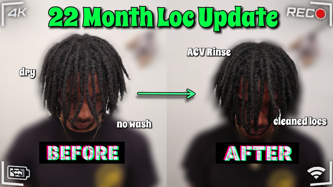 GETTING MY LOCS HEALTHY AGAIN! (ACV Rinse + Wash Day) | 22 Month Loc ...