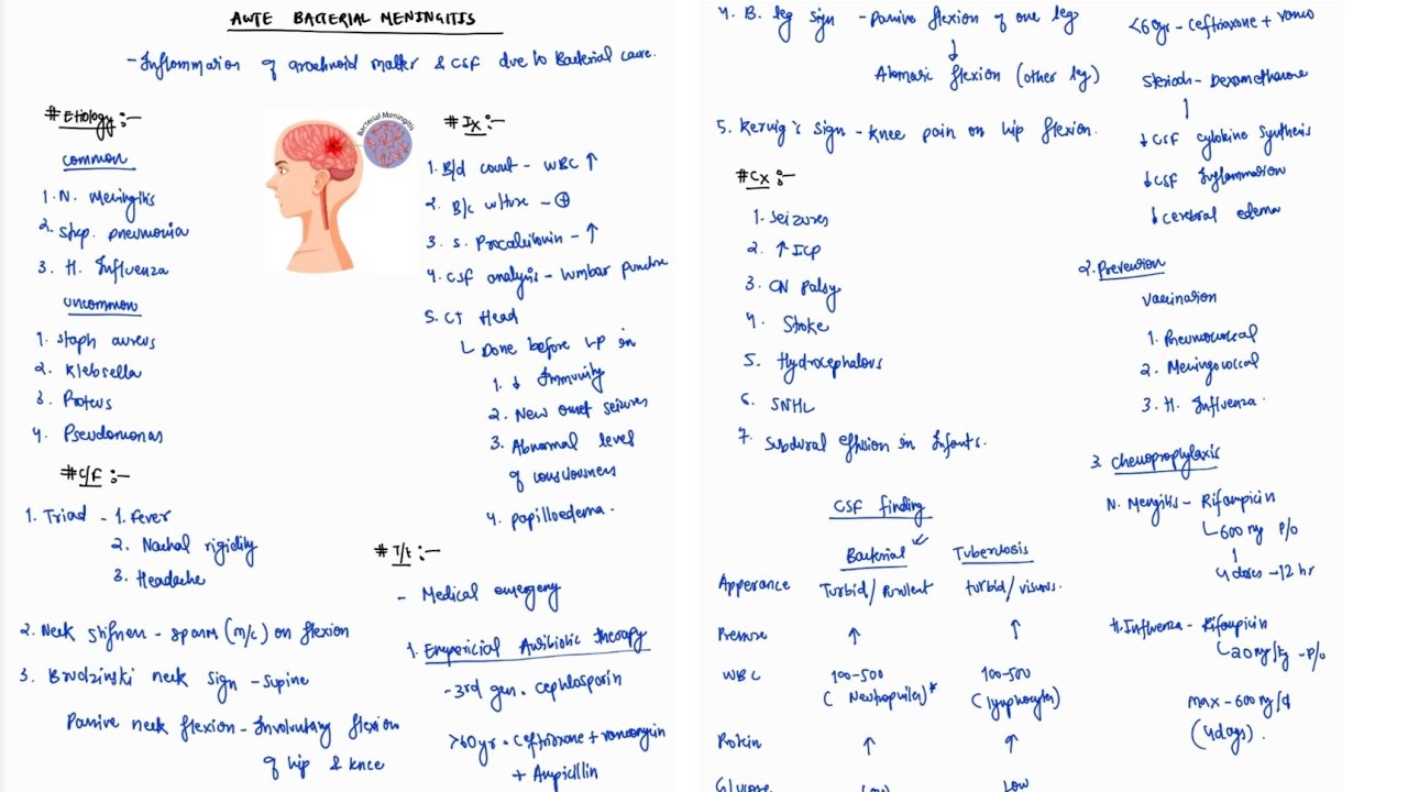 BACTERIAL MENINGITIS NOTES | ONE PAGE NOTES | CNS | MEDICINE | 4TH ...