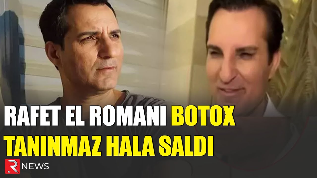 Rafet El Romanı BOTOX tanınmaz hala saldı - RTV - YouTube