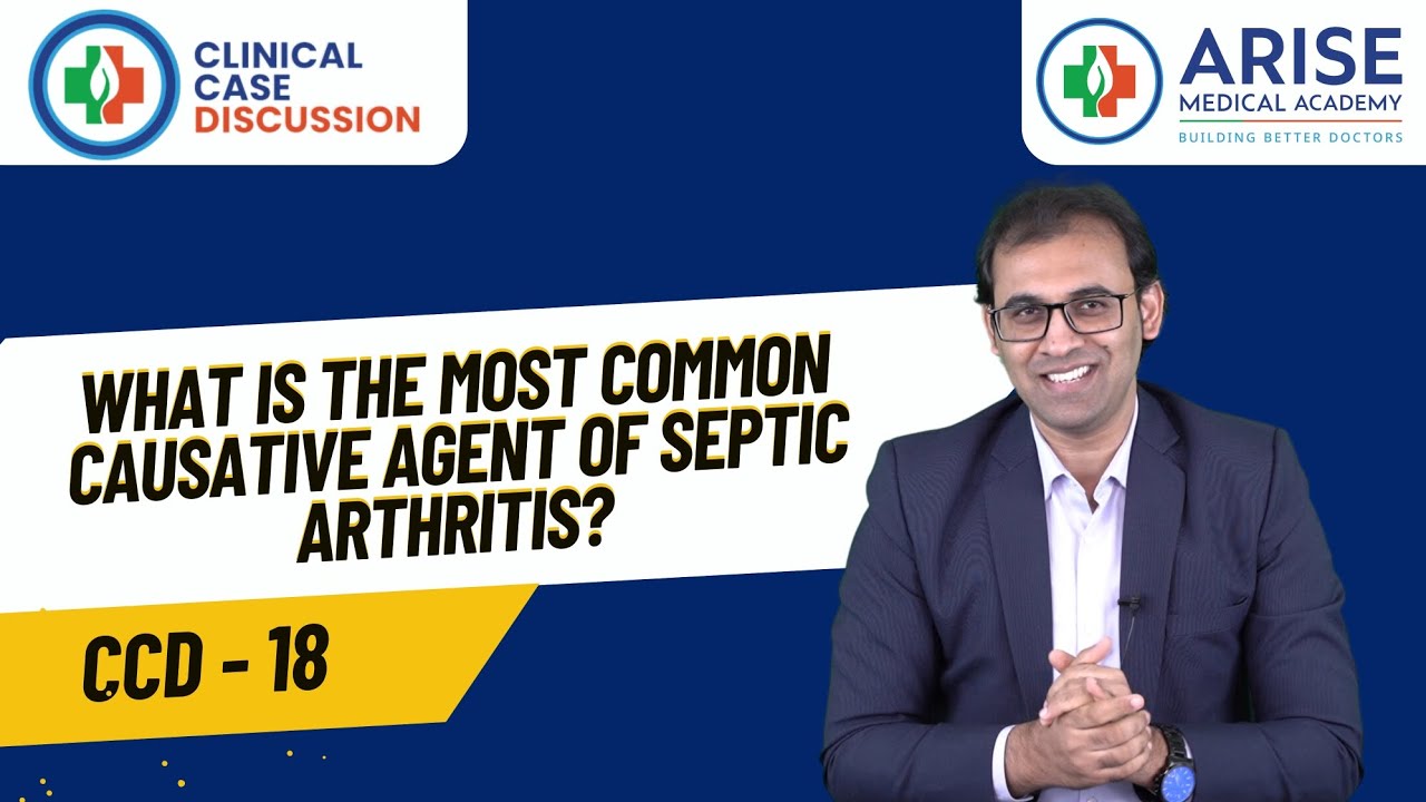 Arise Clinical Case Discussion - 18 | Crack FMGE with ease | Dr Nadeem ...