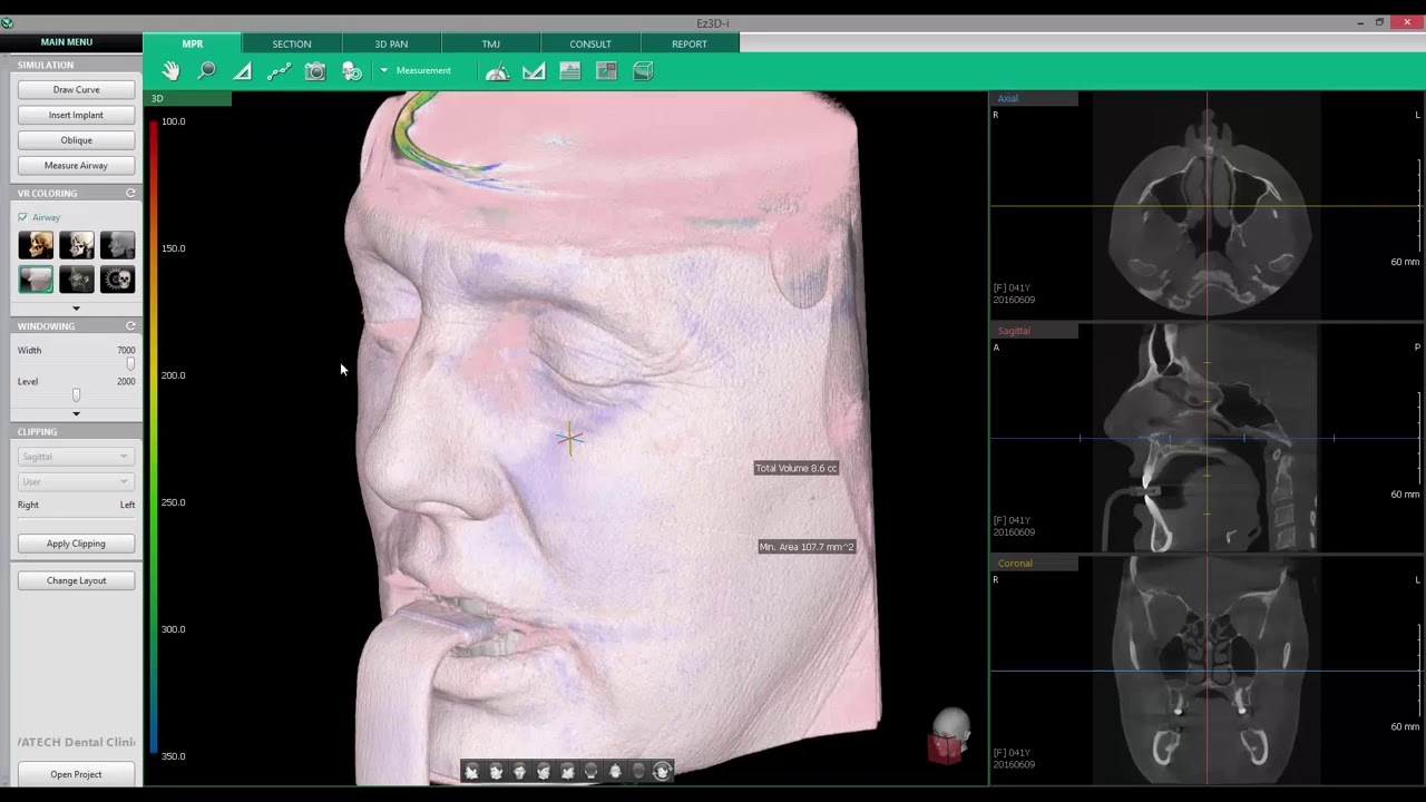 07 Airway Analysis Youtube