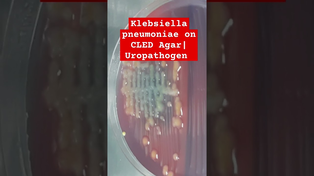 Klebsiella Pneumoniae On Cled Agar