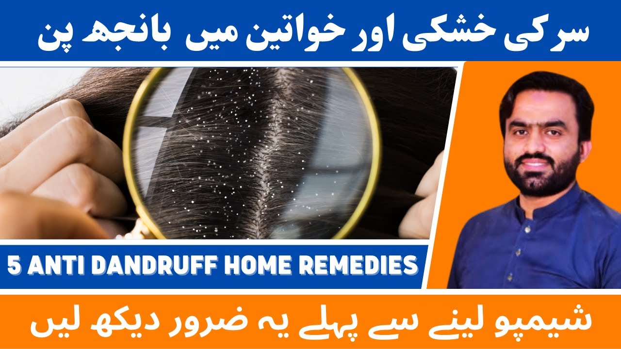 Dandruff Side effects and Causes | Sir ki khushki kaise dur kare ...