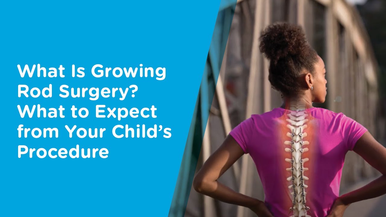 What Is Growing Rod Surgery? What to Expect from Your Child’s Procedure ...