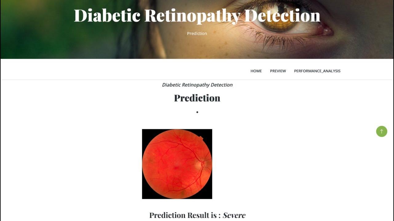 Efficient Detection of Diabetic Retinopathy through Deep Learning | Python IEEE Project 2024 ...