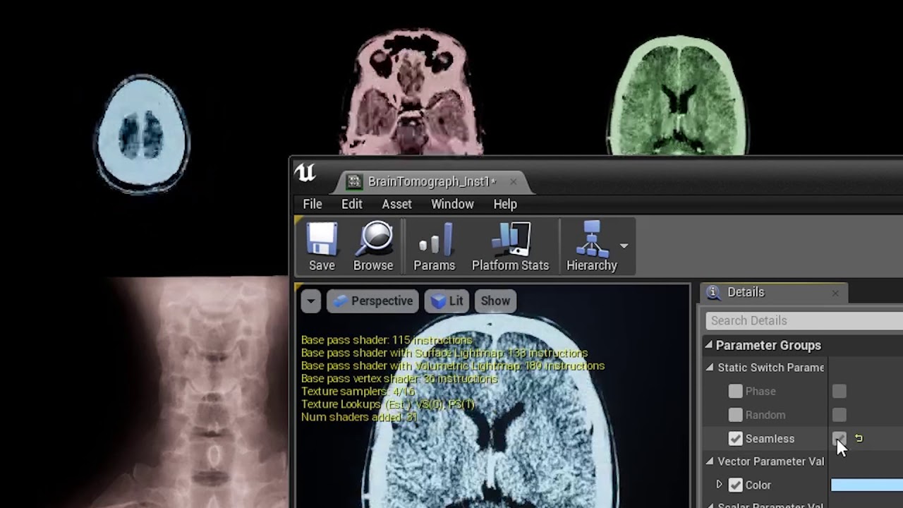 X-Ray and BrainTomograph UE4 Material Animation - YouTube