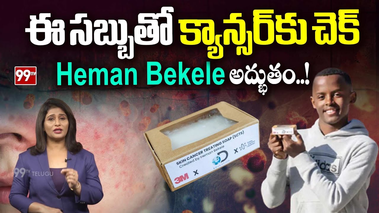 Skin Cancer Treating Soap : ఈ సబ్బు క్యాన్సర్‌కు ఆన్సర్‌ : Heman Bekele ...