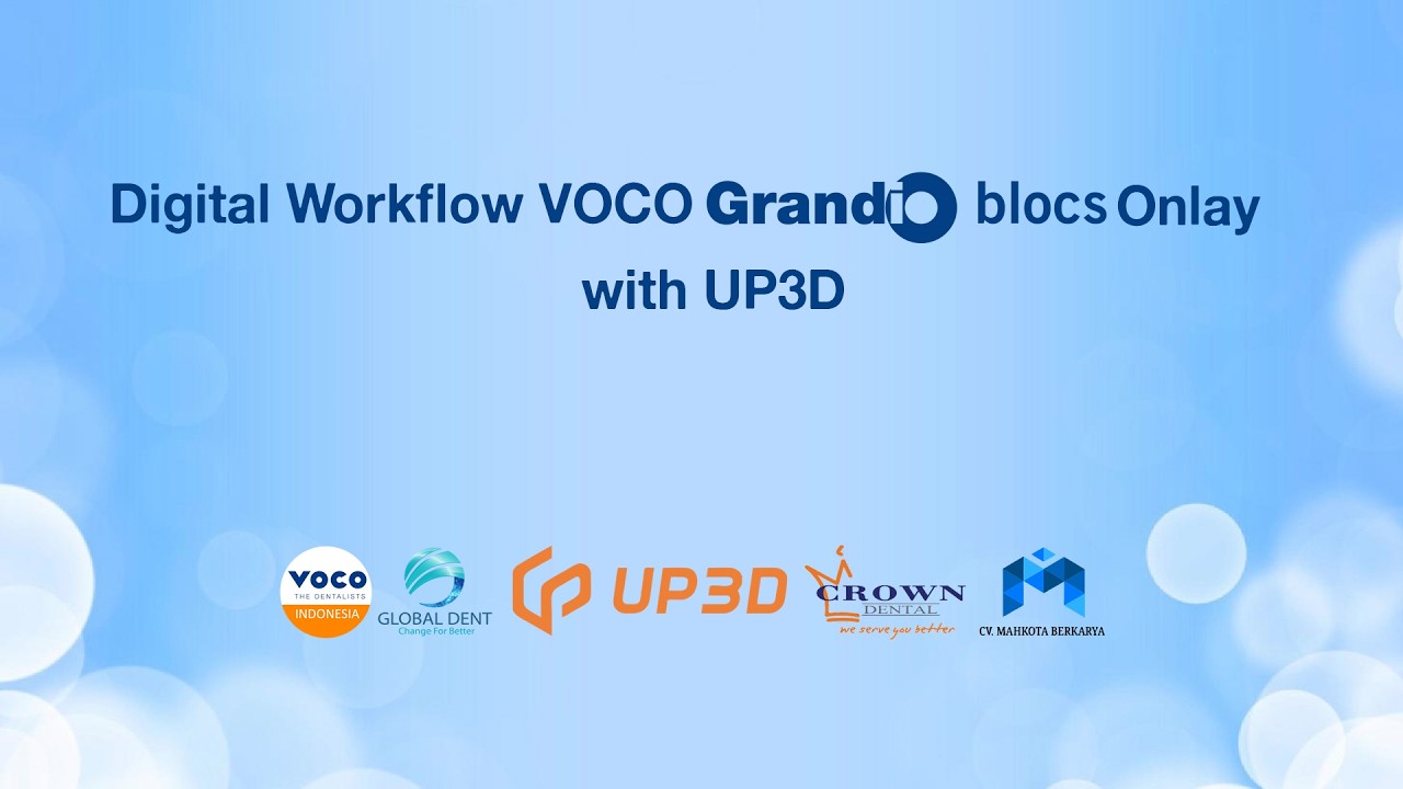 Digital Dentistry Workflow Up3D System Nesting VOCO Grandio Blocs CAD ...