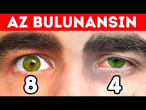 Sahip Olabileceğiniz 18 Ender Rastlanan Vücut Özelliği