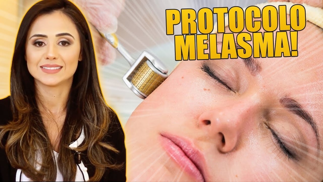 PROTOCOLO MELASMA: COMO CONSIGO TER RESULTADOS NO MICROAGULHAMENTO TRATANDO O MELASMA? - YouTube