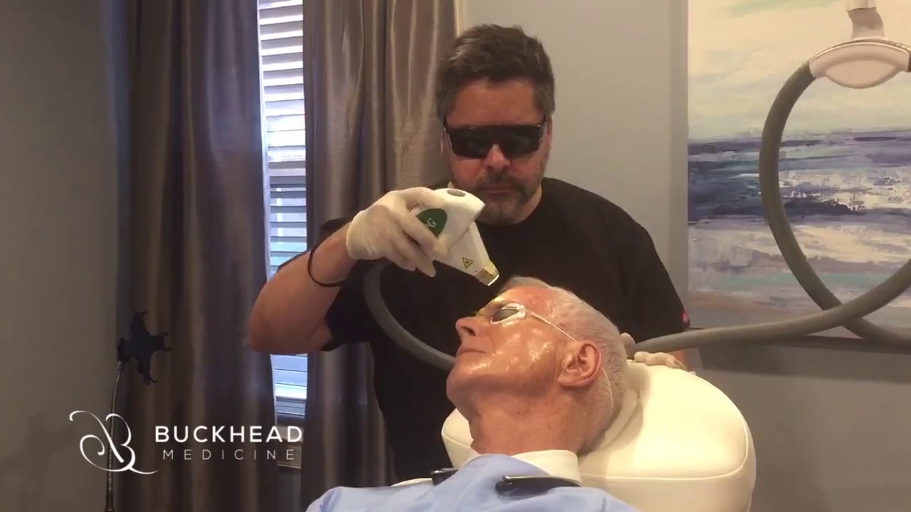 Combo Max G IPL & 1540 Fractional Laser Treatment - YouTube