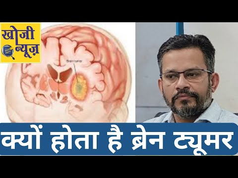 क्यों होता है Brain Stroke और क्या है इसके लक्षण। Khoji News। MJ Hospital Shahpur। Dr ...