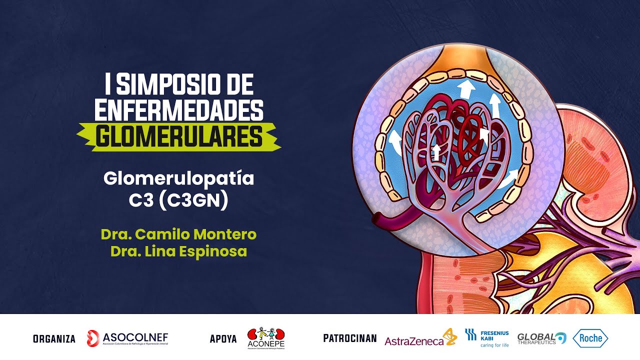 Glumerulonefritis C3, un caso de recurrencia postrasplante Dr. Camilo ...