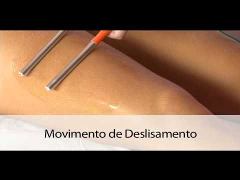 STIMULUS FACE MICROCORRENTES BASTÃO HTM - YouTube
