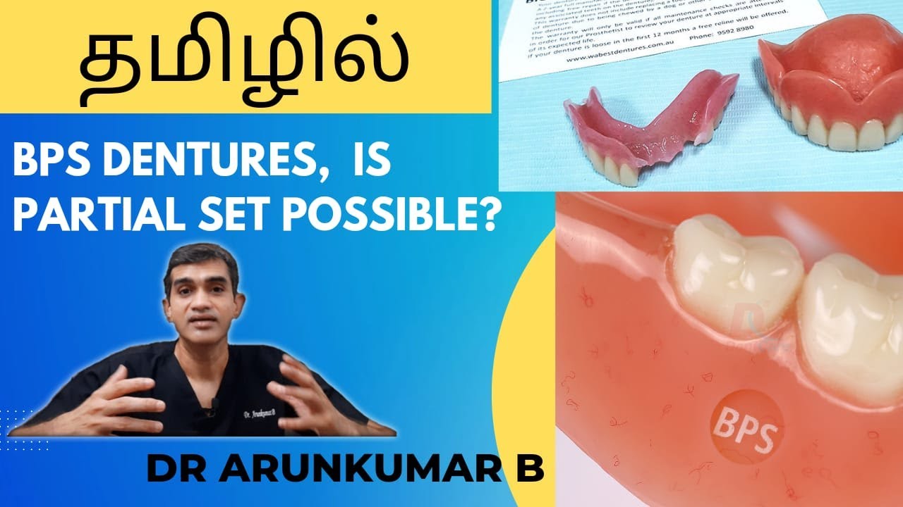 தமிழில் BPS Dentures is Partial Set Possible? பல் செட் Dr Arunkumar ...